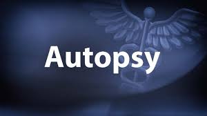 Autopsy Performed on Body of Alphonso Collins – NevisPages.com